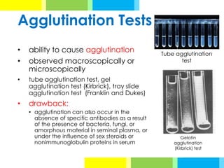 Antisperm antibody | PDF