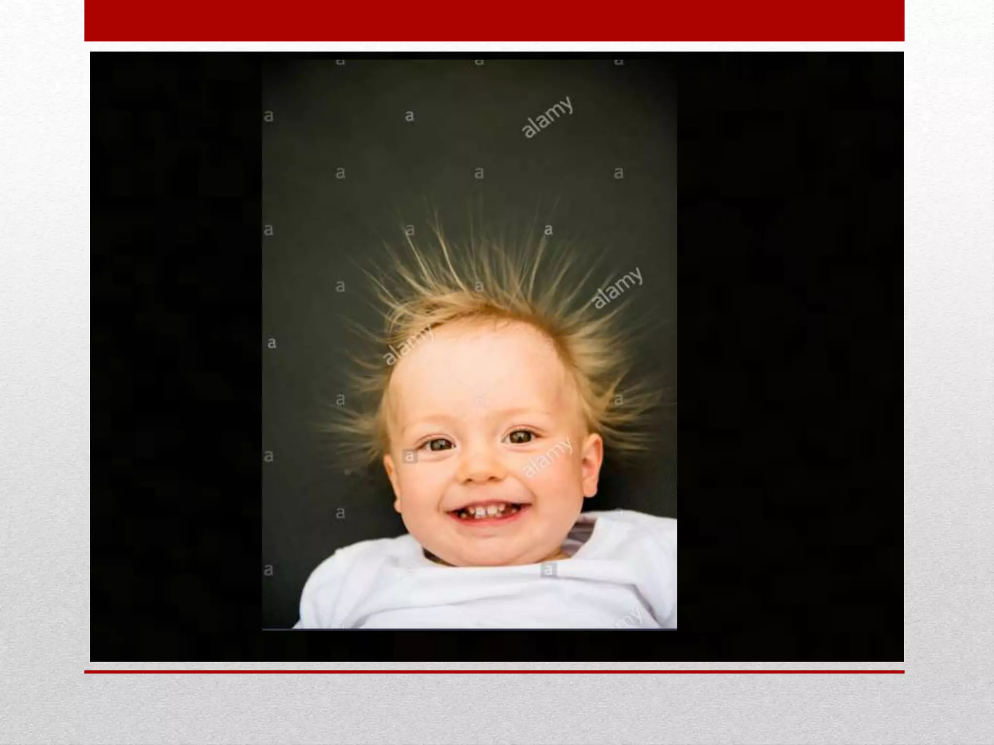 Antistatic finish in textile | PPTX