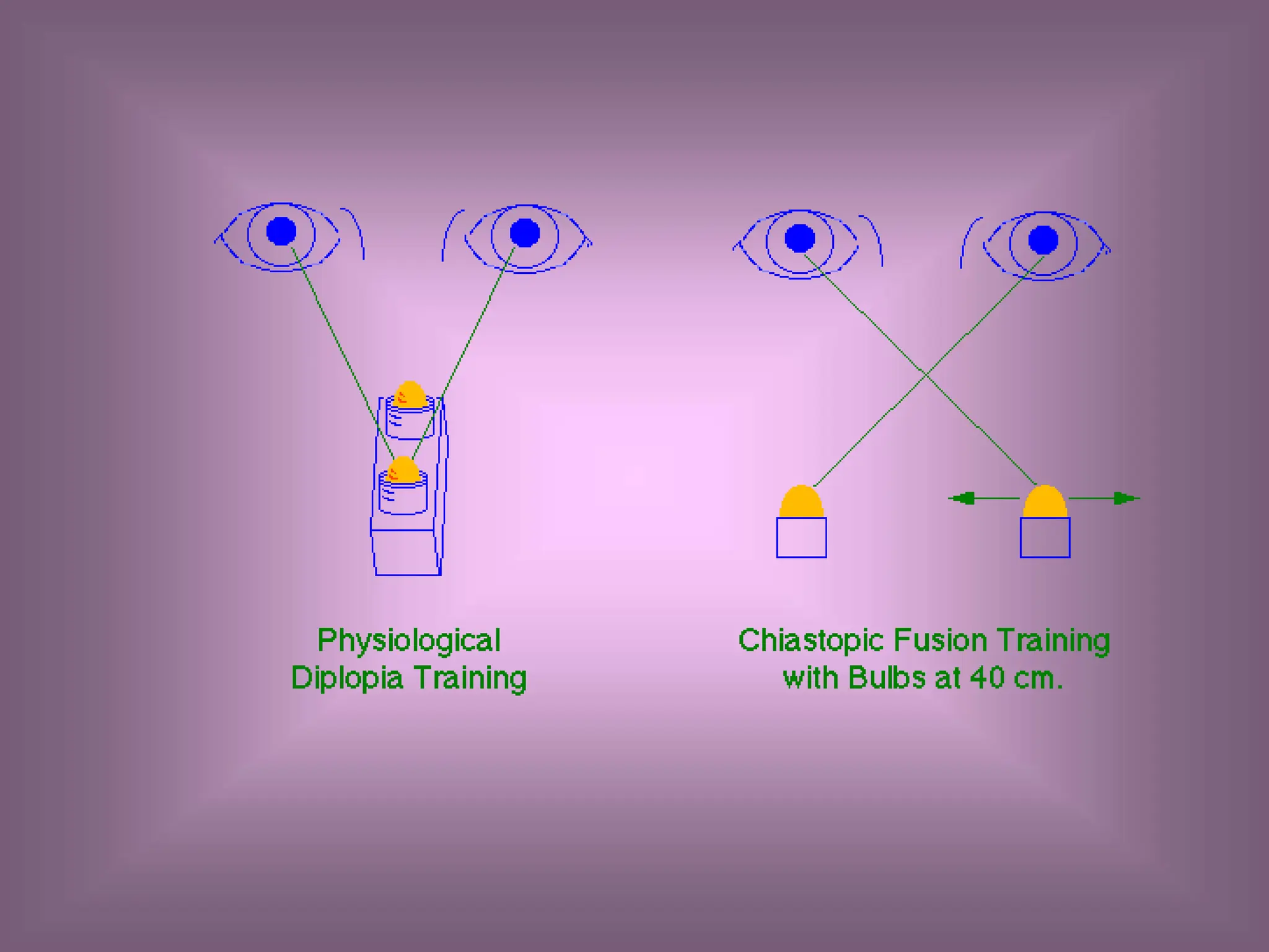 antisuppression exercises.ppt