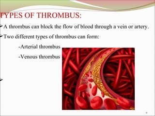 Anti thrombiotic therapy (1) | PPT