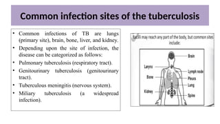 Anti tubercular drug Medicinal Chemistry III | PPT