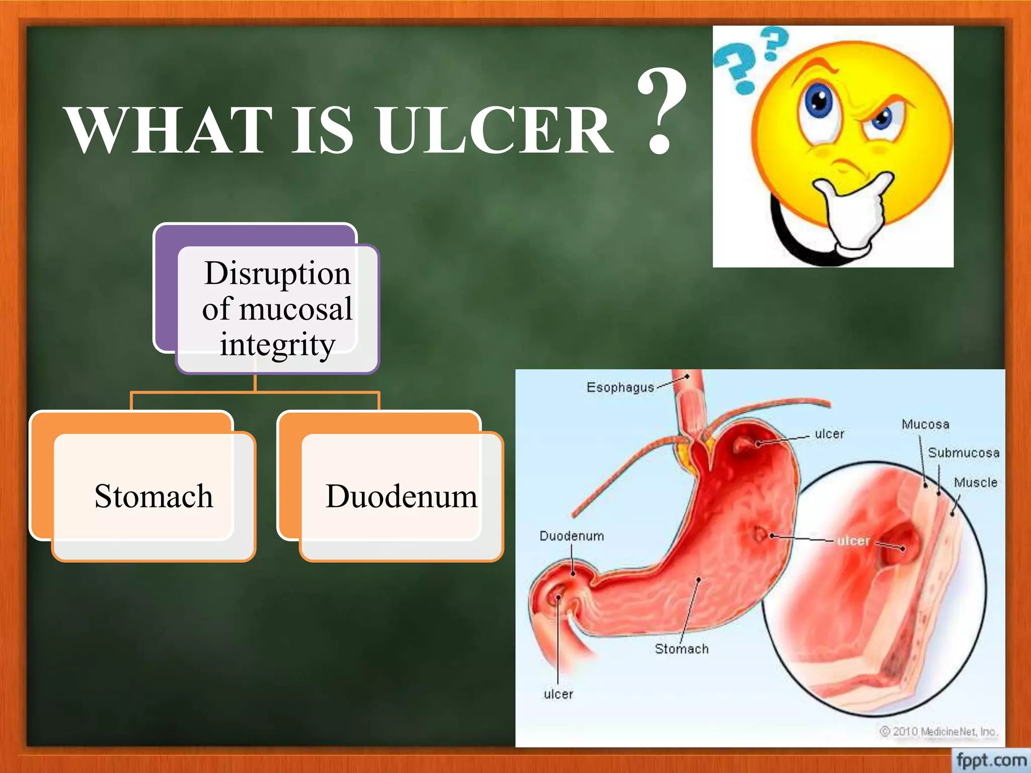 Anti ulcer | PPTX