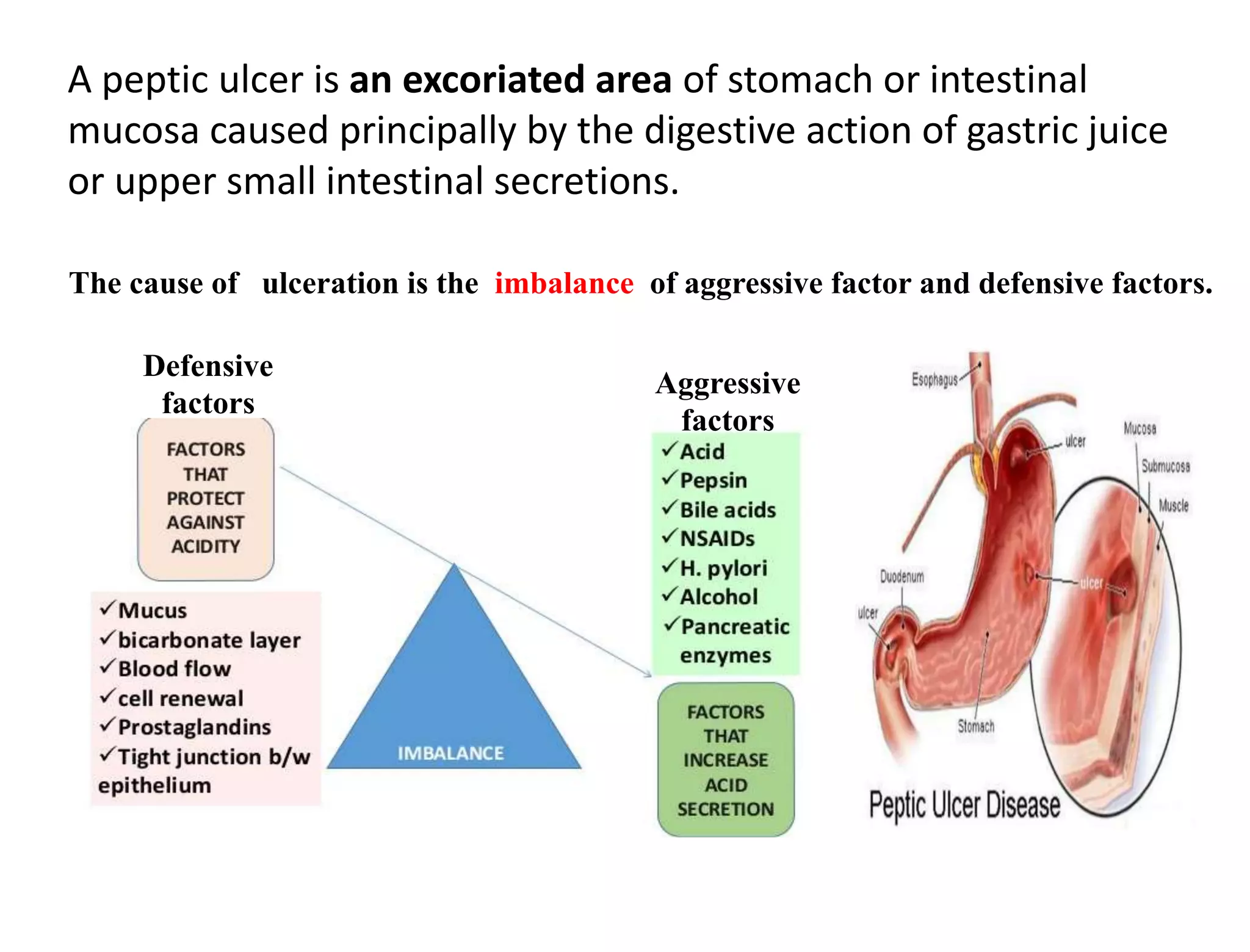 Anti ulcer drug | PPTX