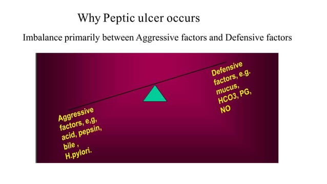 Anti Ulcer drugs pharmacology and classification | PPTX | Digestive ...