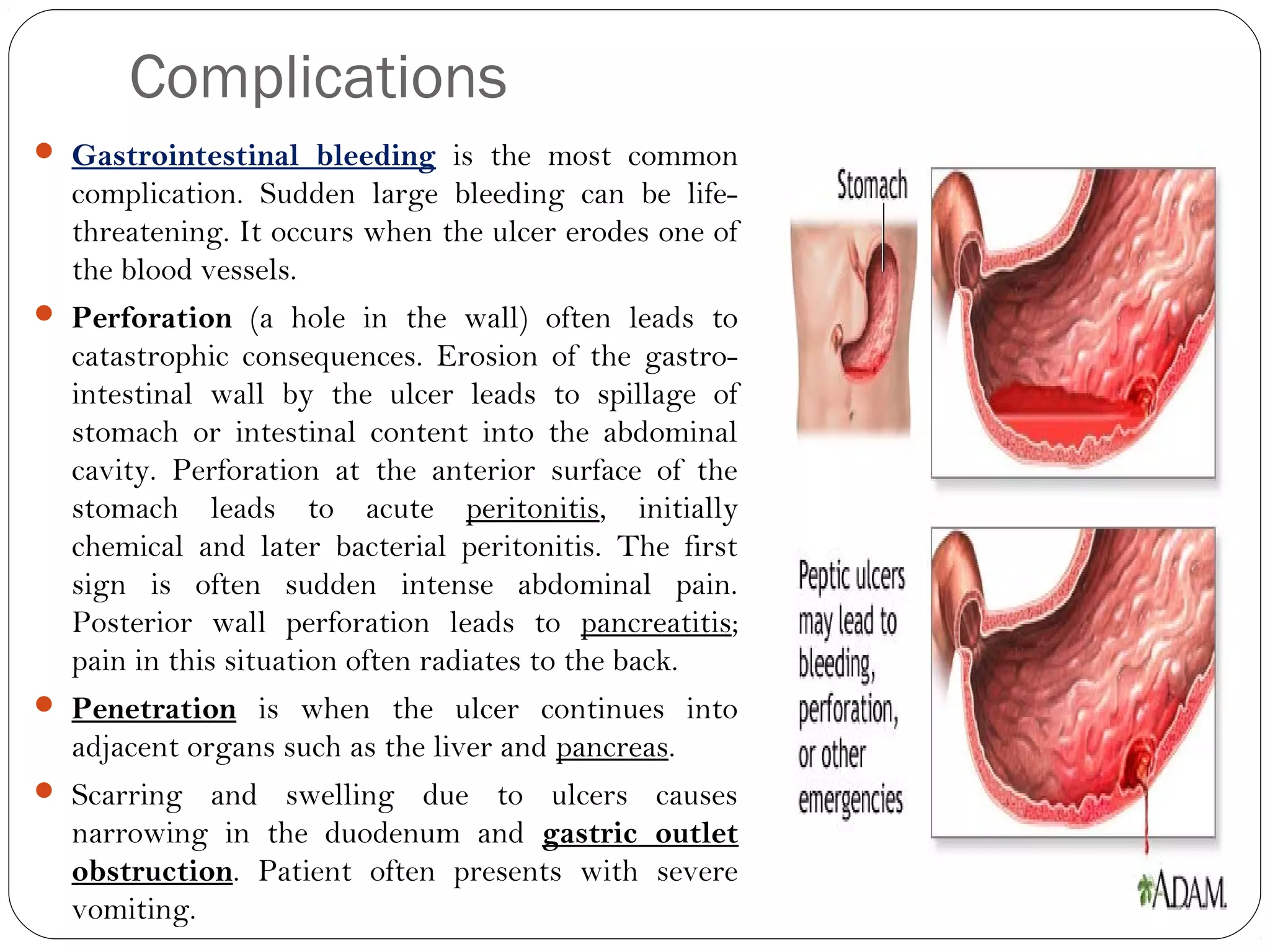 Anti ulcer drugs classification | PPT