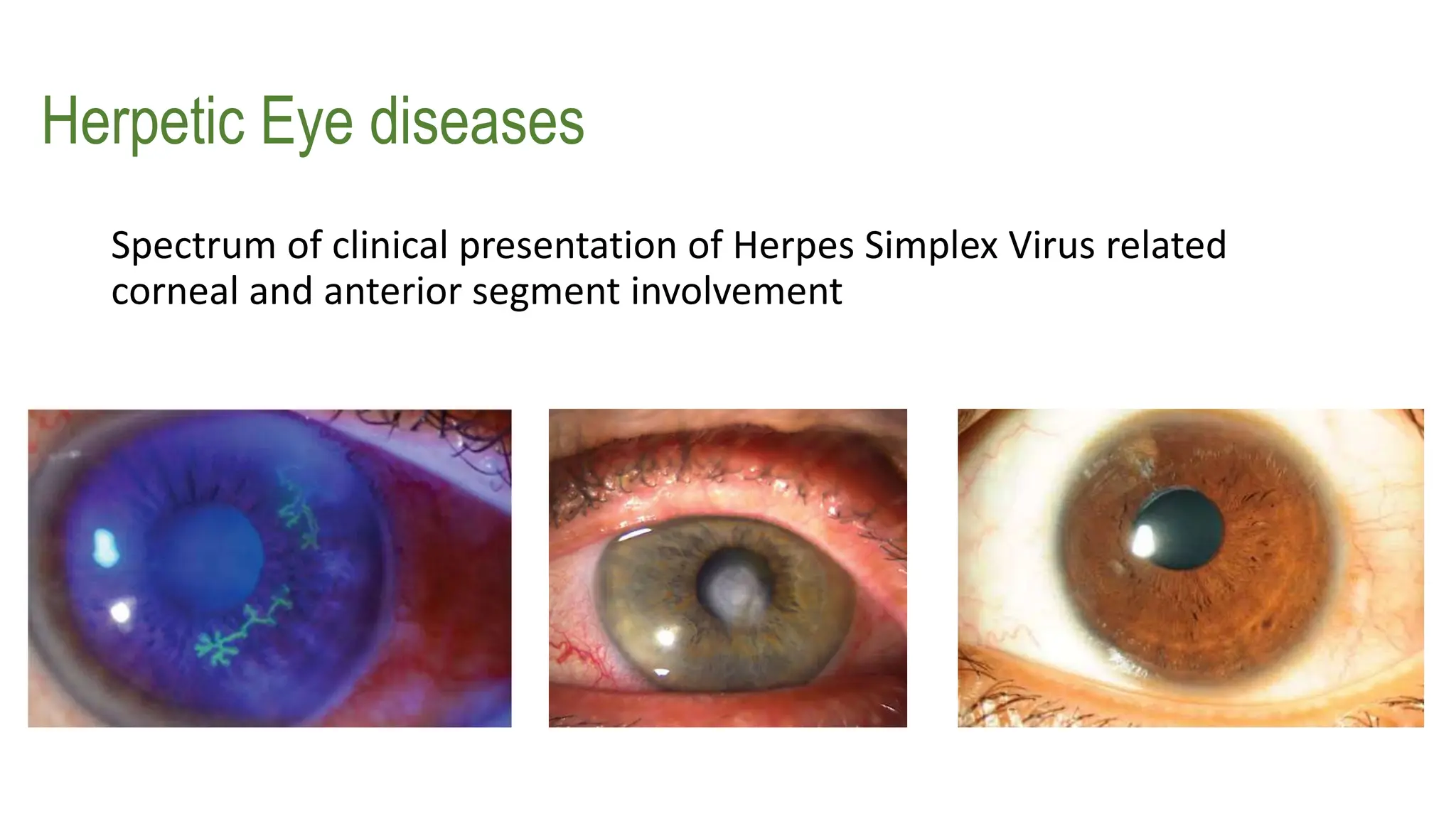 Anti-viral drugs in ophthalmic practice simplified | PPTX