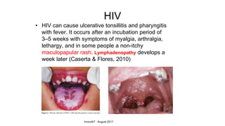 antiviral in respiratory infection - Copy.pptx