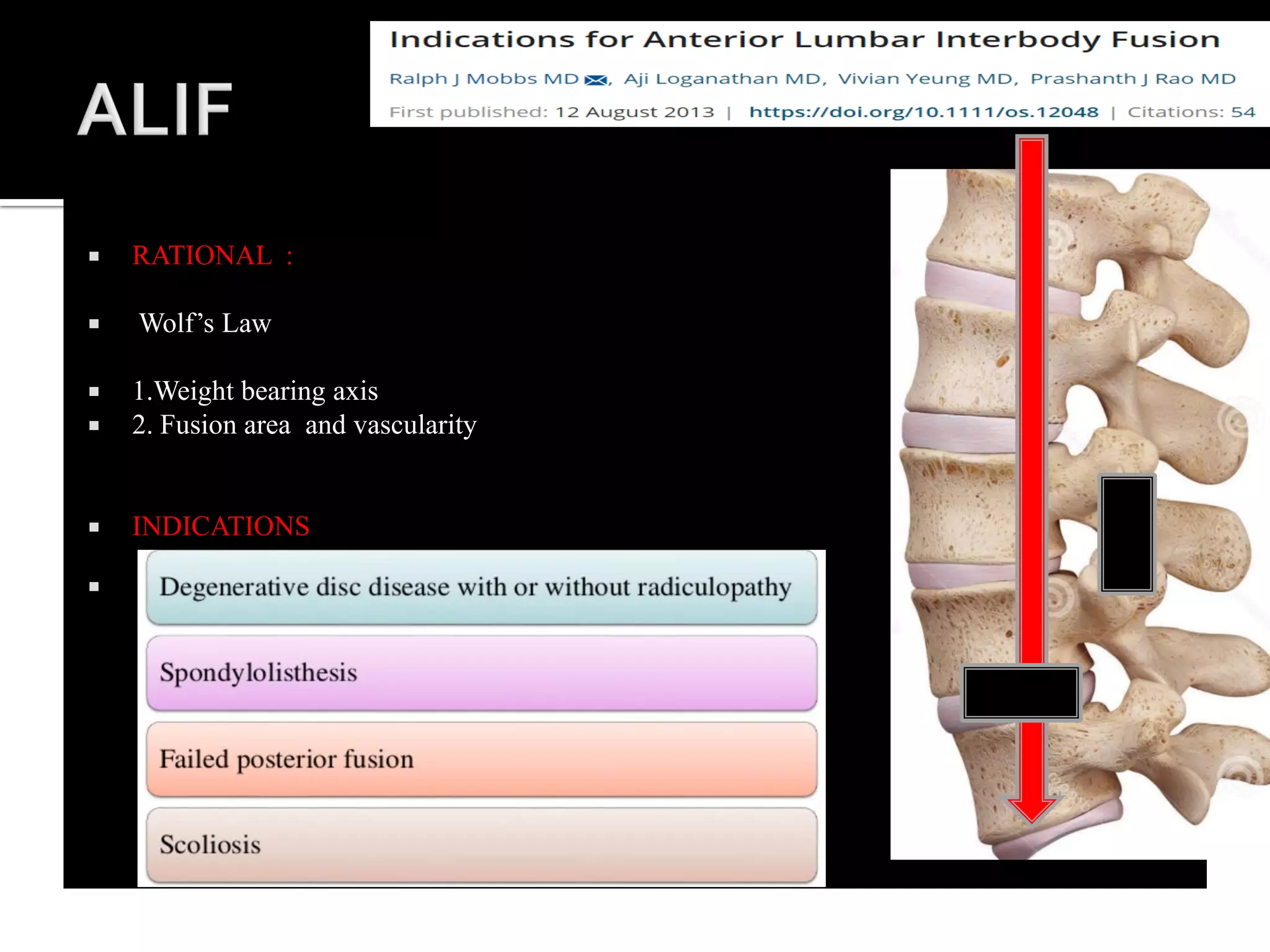 Anterior / lateral lumbar interbody Fusion | PDF