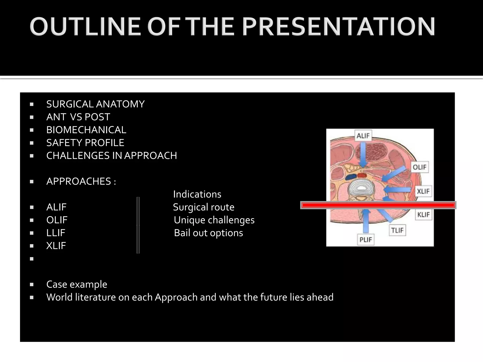 Anterior / lateral lumbar interbody Fusion | PDF