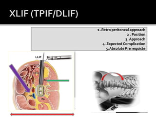 Anterior / lateral lumbar interbody Fusion | PDF
