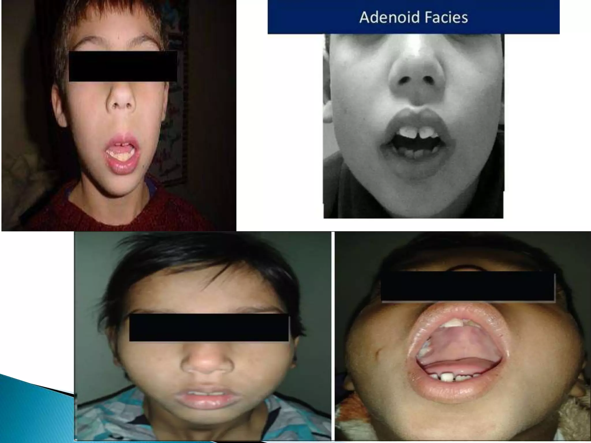 Antomy of pharynx | PPTX