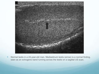 Antomy of scrotum and testis | PPTX