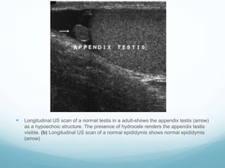 Antomy of scrotum and testis | PPTX