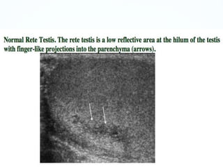 Normal Testis Images