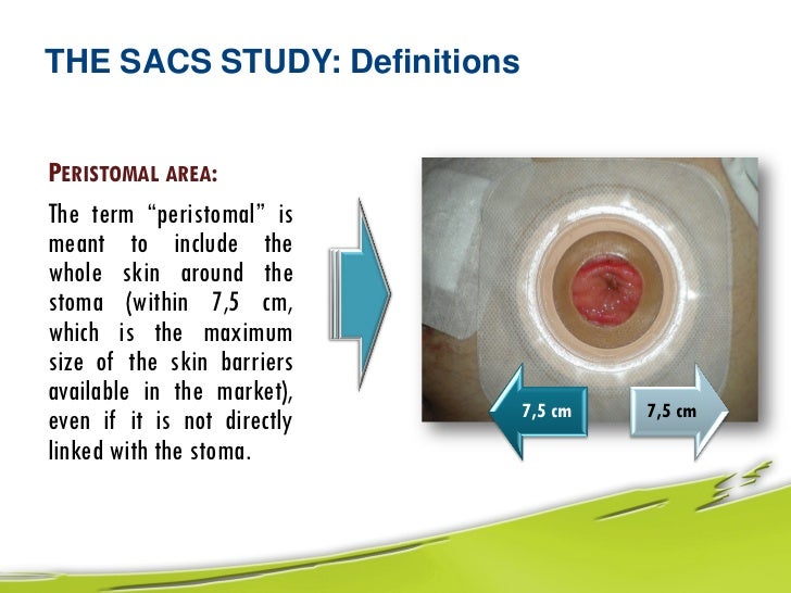 Implementing a Validated Peristomal Skin Assessment Instrument into C…