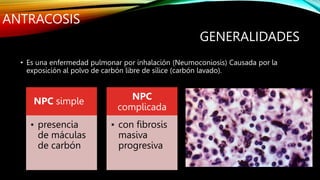 La enfermedad de los trabajadores del carbon, Antracosis.pptx