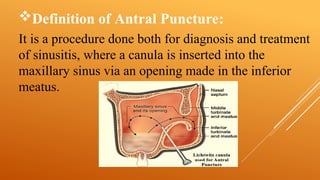 Antral Puncture and Sinus Lavage (Washout).pptx