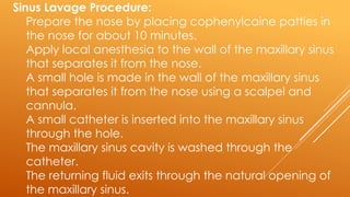 Antral Puncture and Sinus Lavage (Washout).pptx