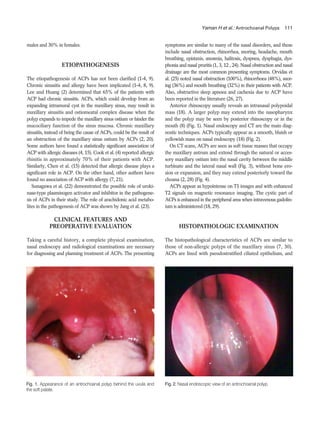 Antrochoanal polyp | PDF