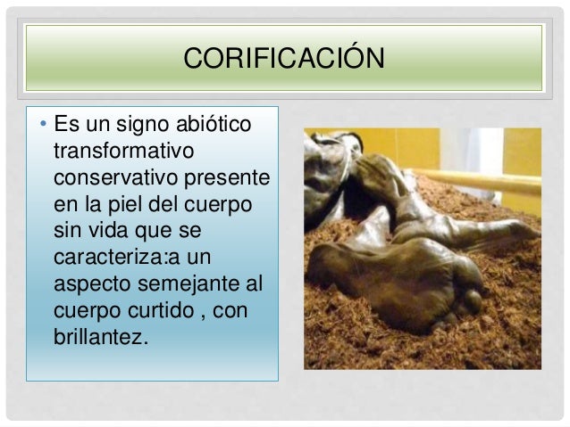 Antropología forense ( identidad e Identificacion)