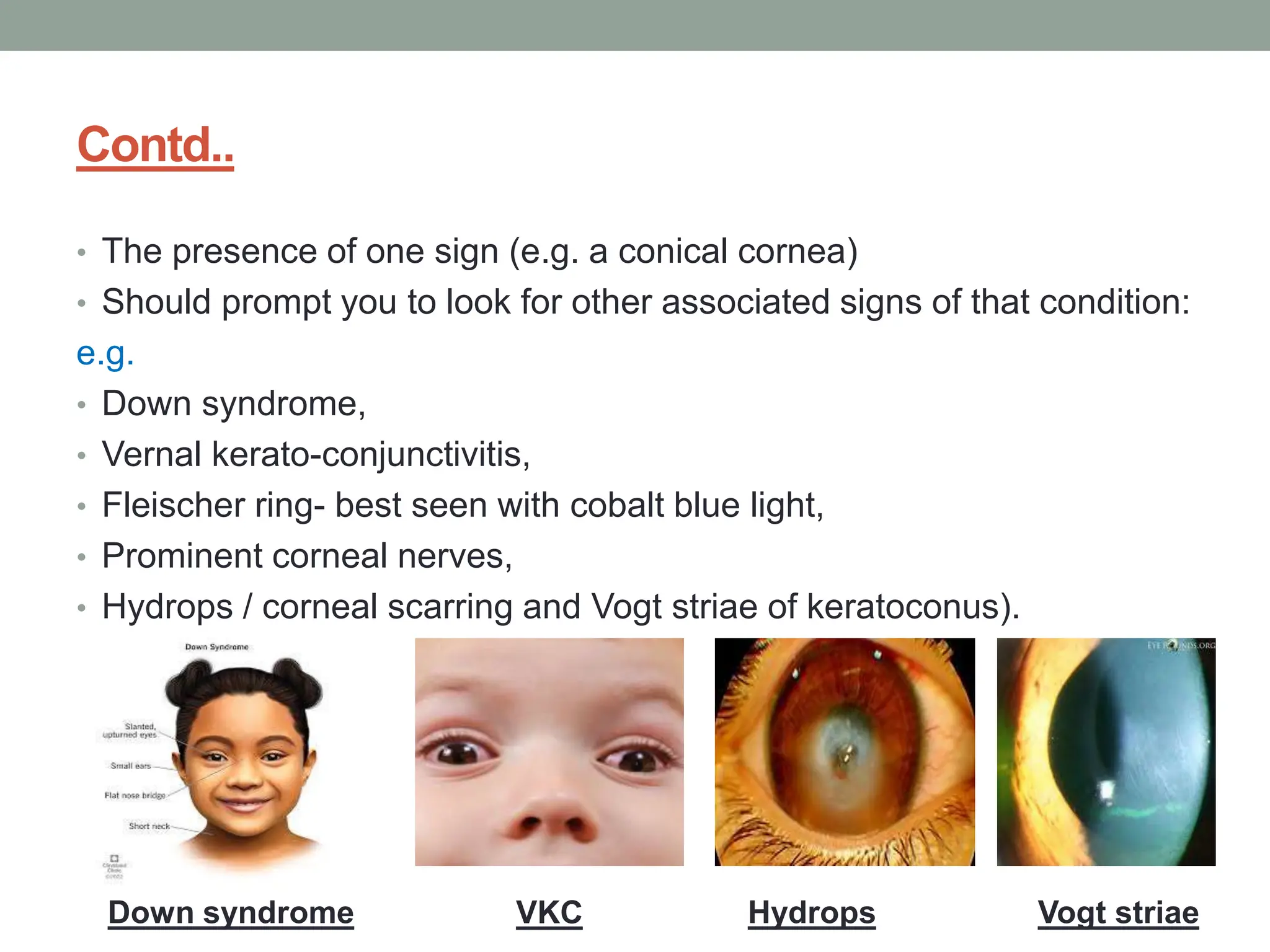 ANTERIOR SEGMENT EXAMINATION.PPTX....... | PPT