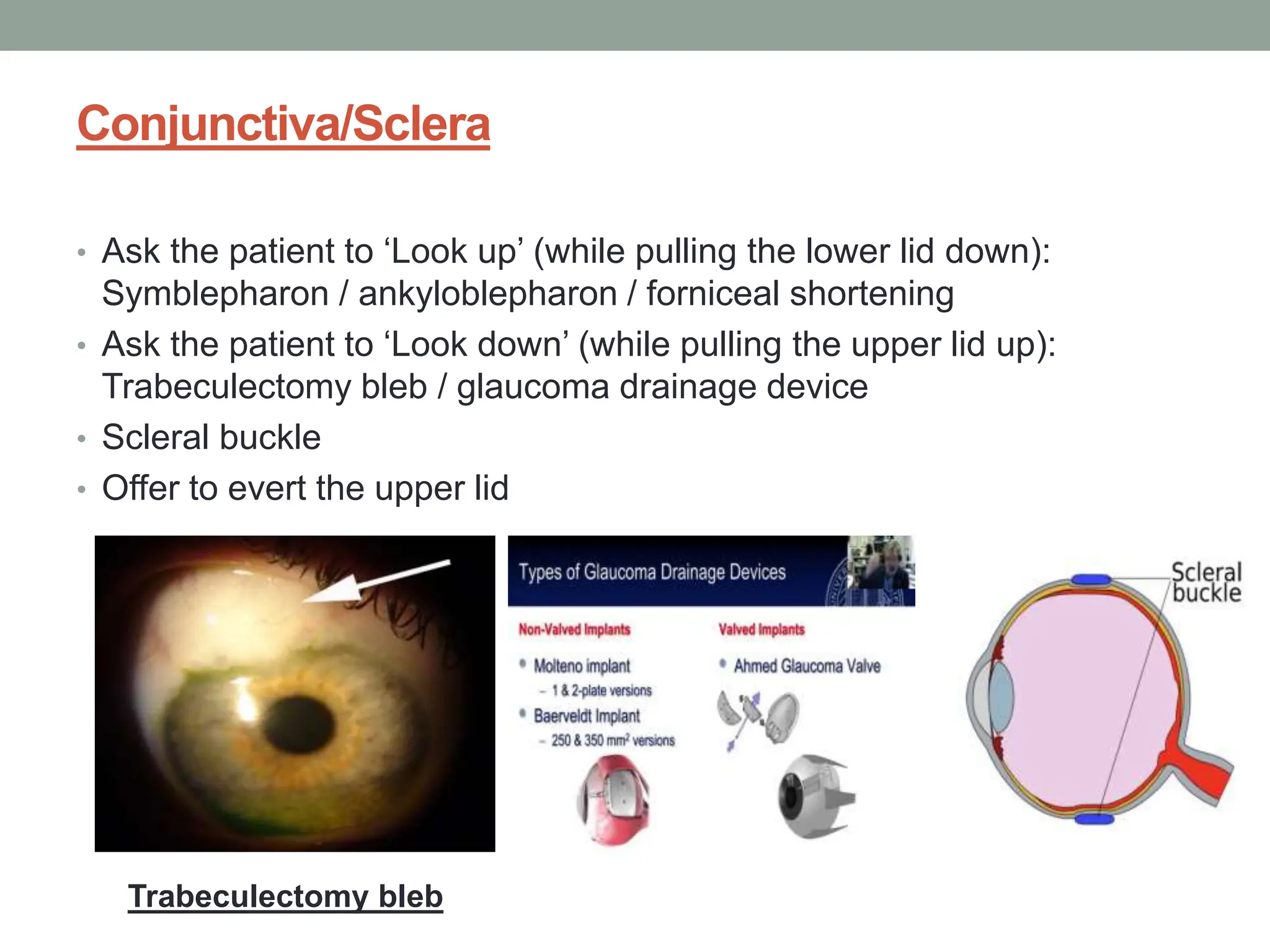 ANTERIOR SEGMENT EXAMINATION.PPTX....... | PPTX