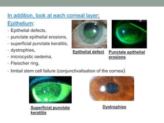 ANTERIOR SEGMENT EXAMINATION.PPTX....... | PPT