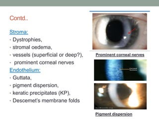 ANTERIOR SEGMENT EXAMINATION.PPTX....... | PPT