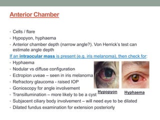 ANTERIOR SEGMENT EXAMINATION.PPTX....... | PPT