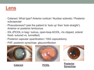 ANTERIOR SEGMENT EXAMINATION.PPTX....... | PPT