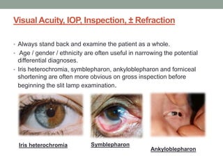 ANTERIOR SEGMENT EXAMINATION.PPTX....... | PPT