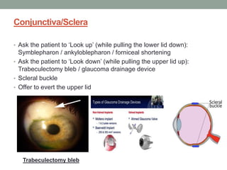 ANTERIOR SEGMENT EXAMINATION.PPTX....... | PPT