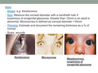 ANTERIOR SEGMENT EXAMINATION.PPTX....... | PPT