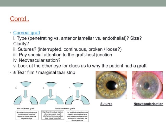 ANTERIOR SEGMENT EXAMINATION.PPTX....... | PPT