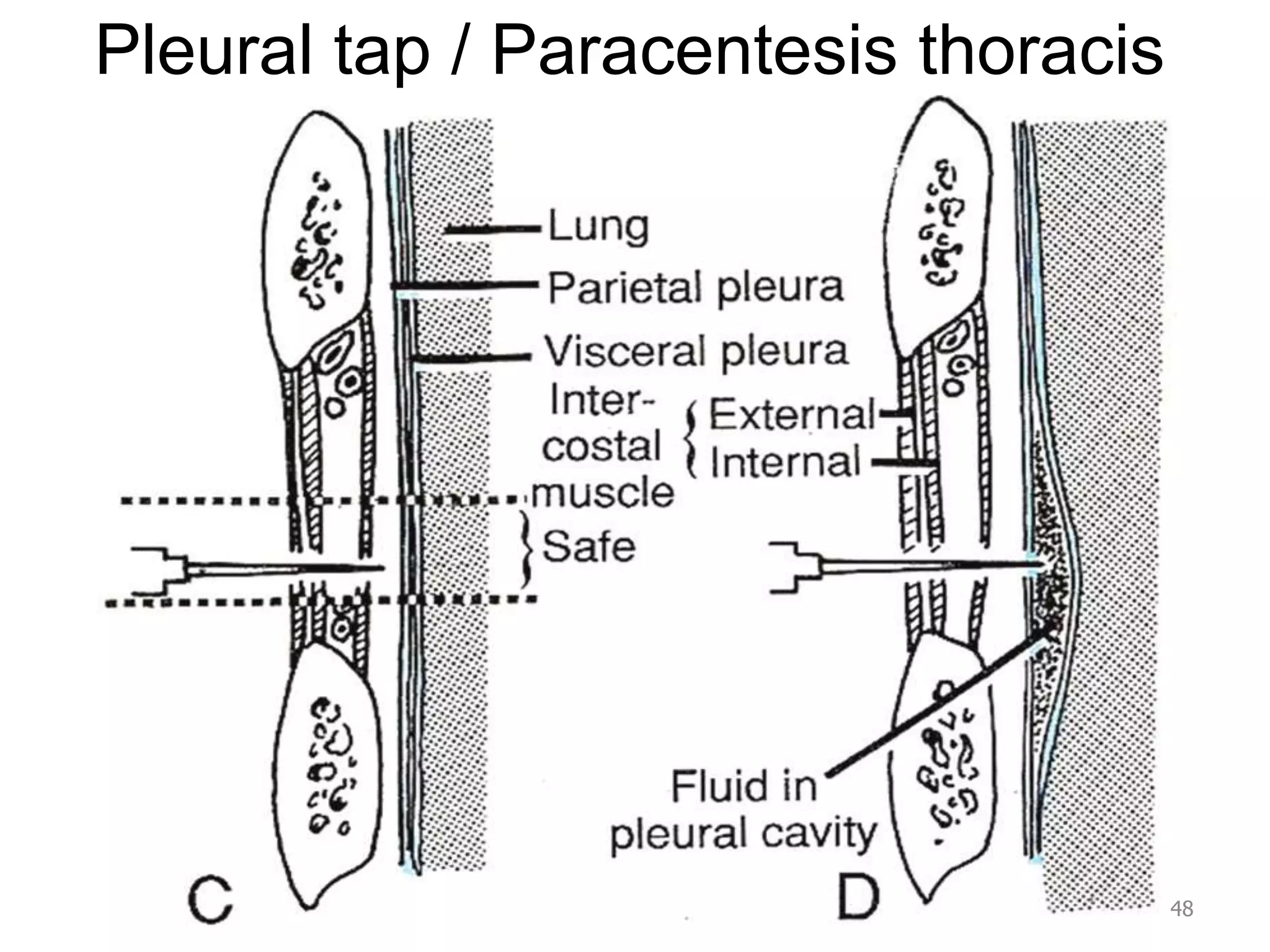 Ant thoracic wall and intercostal space | PPT