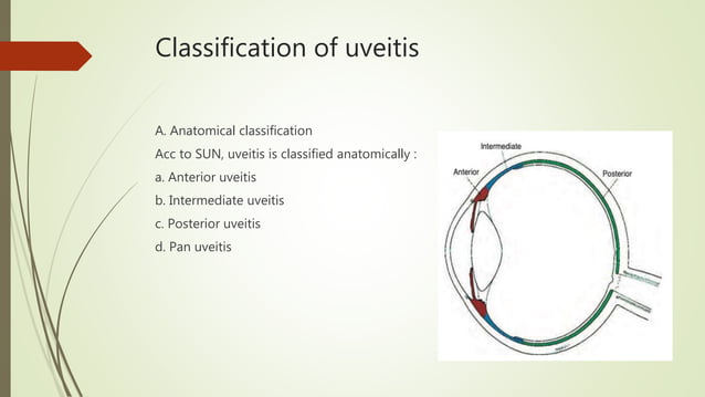Anterior uveitis - SIGNS, SYMPTOMS AND TREATMENT | PPTX | Eye and Vision Conditions | Diseases ...