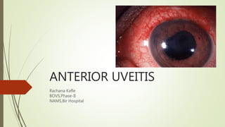 Anterior Uveitis