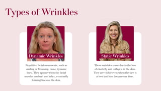 Wrinkles: Causes and Non-Invasive Anti-Wrinkle Treatments | PPTX