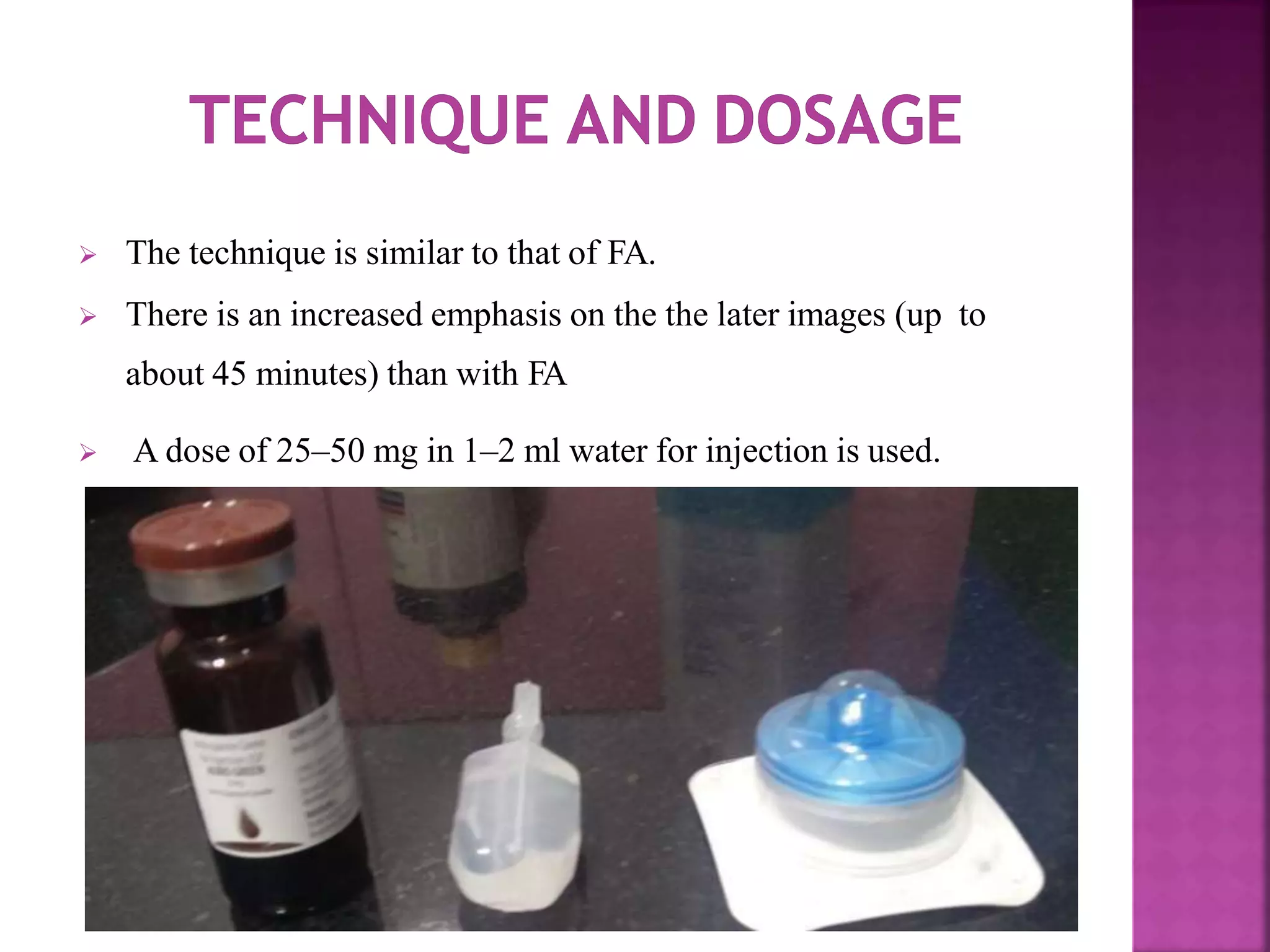 Indocyanine Green Angiography (ICG) | PPTX