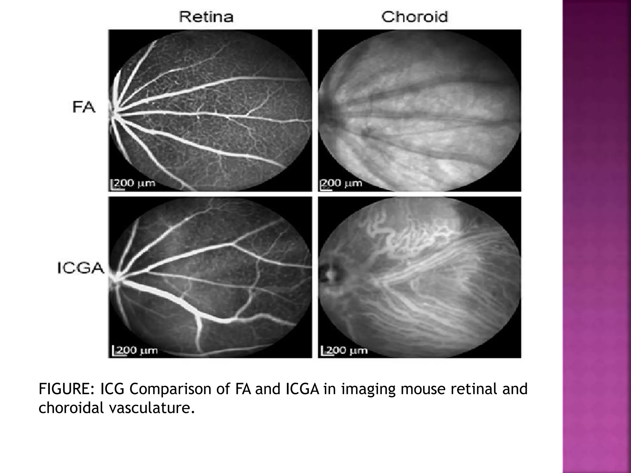 Indocyanine Green Angiography (ICG) | PPTX