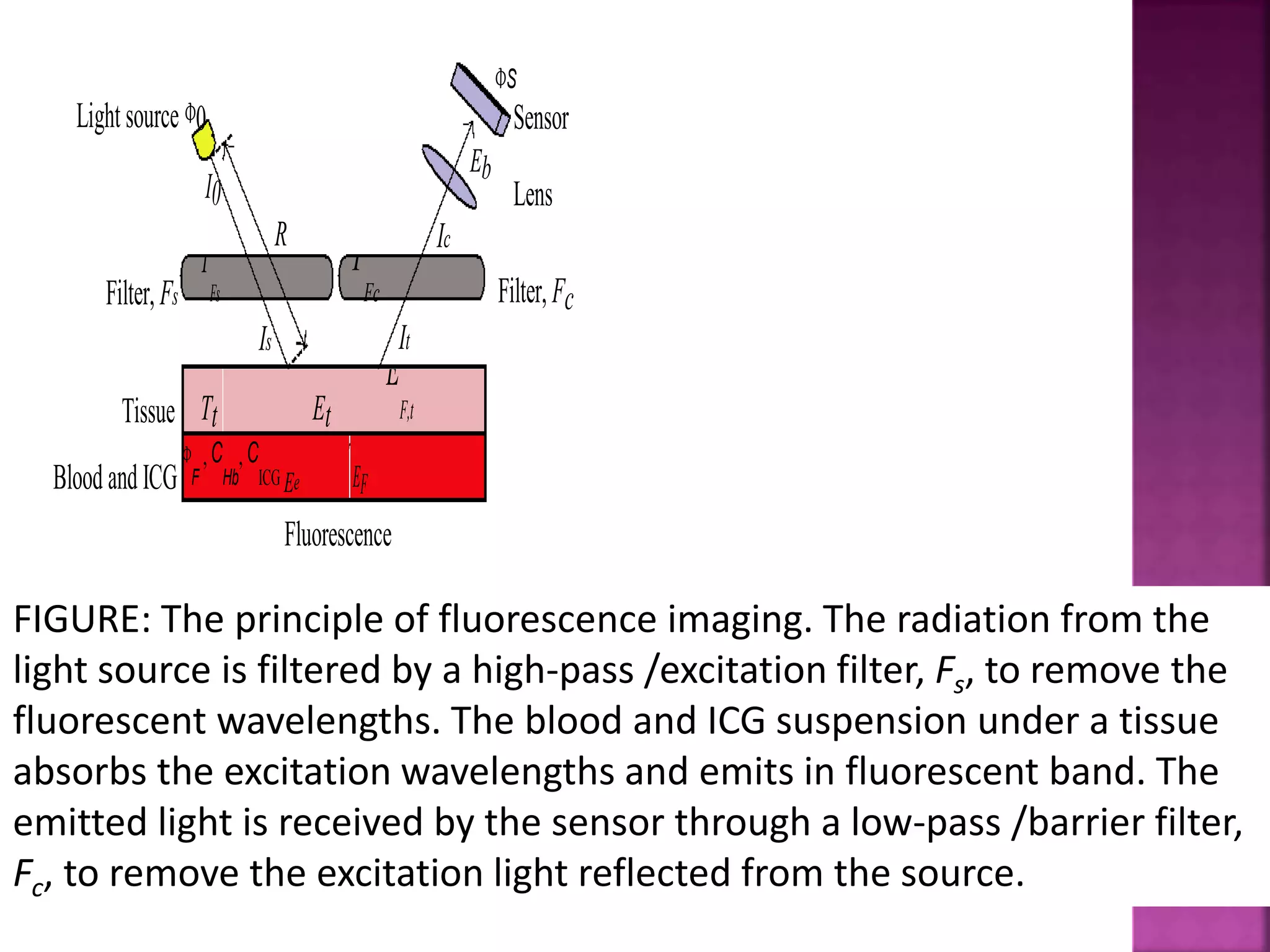 Indocyanine Green Angiography (ICG) | PPTX