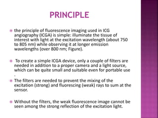 Indocyanine Green Angiography (ICG) | PPTX