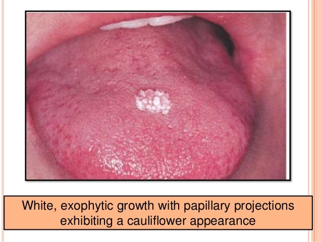 BENIGN TUMORS OF EPITHELIAL ORIGIN