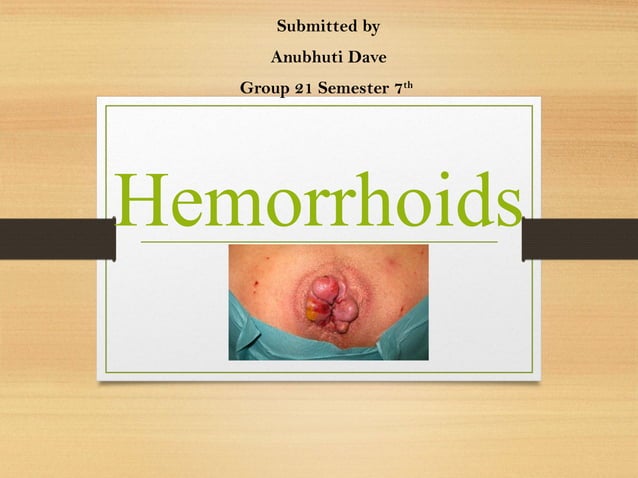 hemorrhoids | PPT | Digestive Disorders | Diseases and Conditions