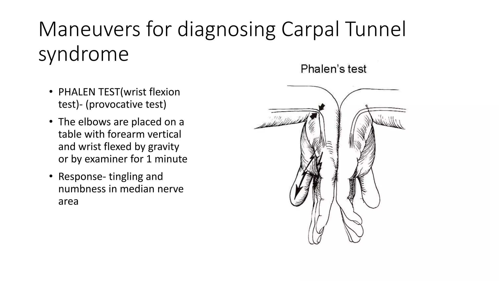 carpal tunnel syndrome | PPTX