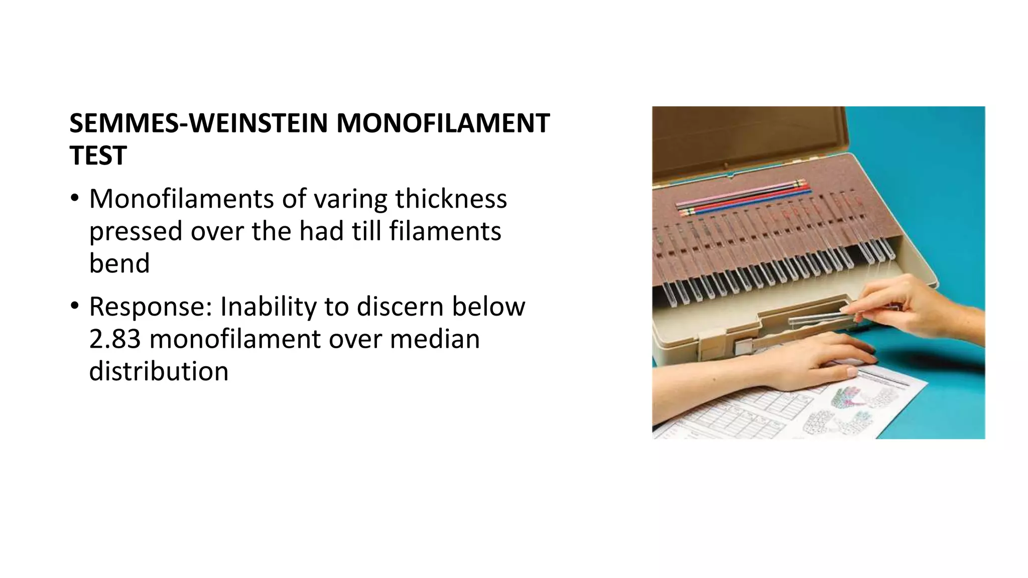 carpal tunnel syndrome | PPTX