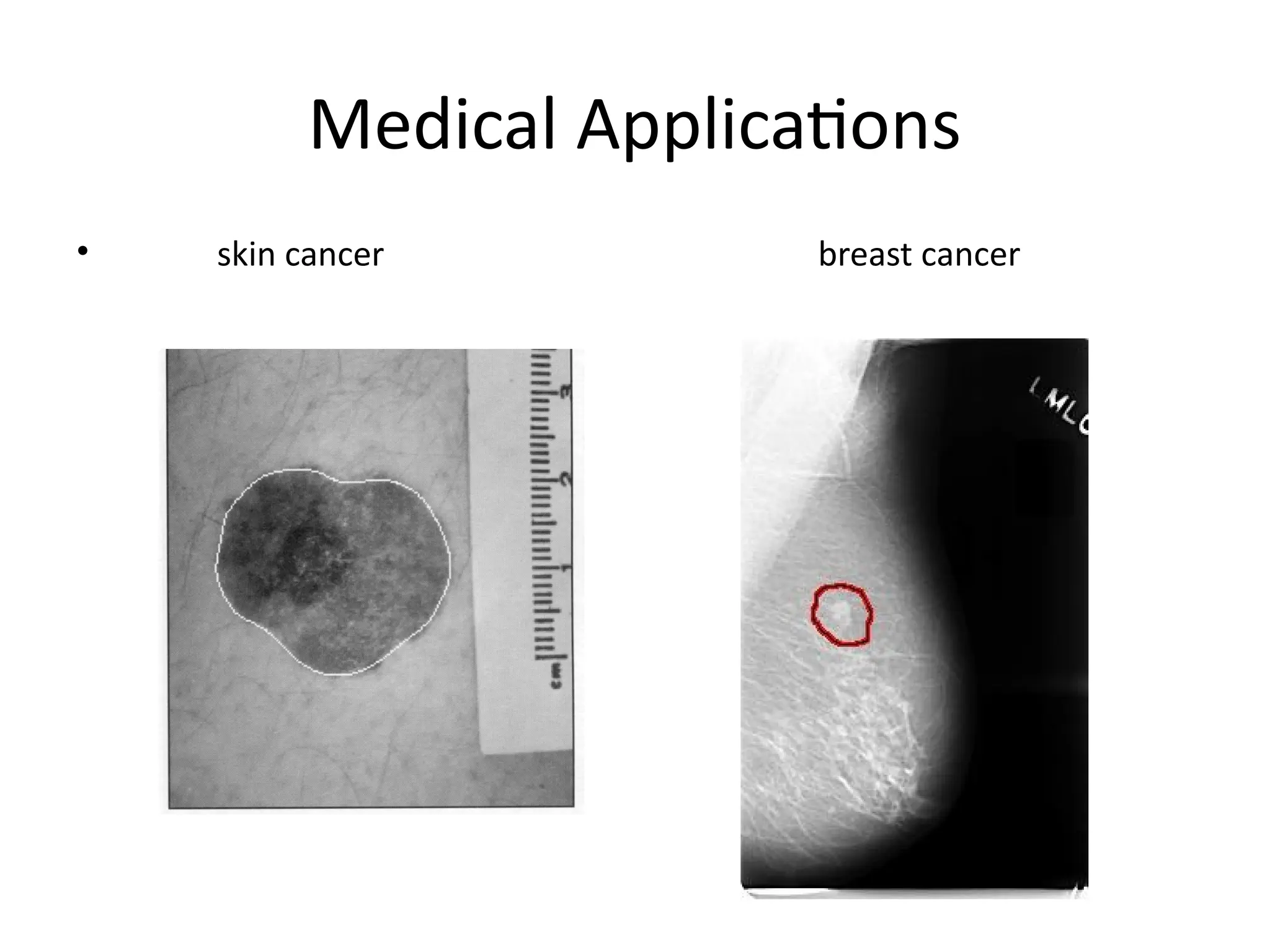 anu dip chapter 1 (1).pptx key stages of image | PPT