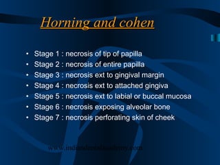 Acute necrotising ulcerative gingivitis , ANUG /certified fixed ...