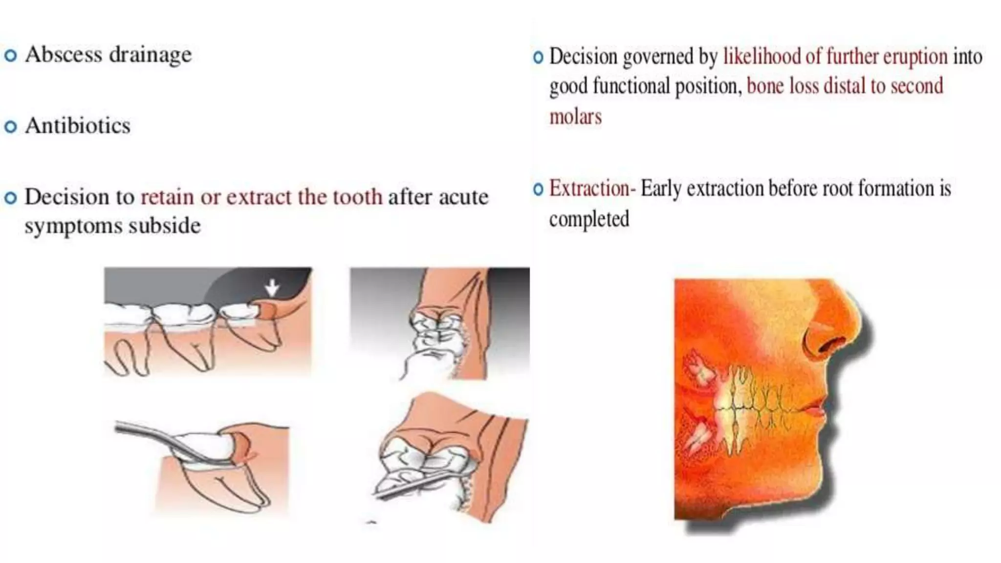 Acute gingival infections PERIO ppt | PPTX