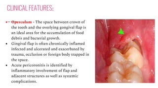 Acute gingival infections PERIO ppt | PPT